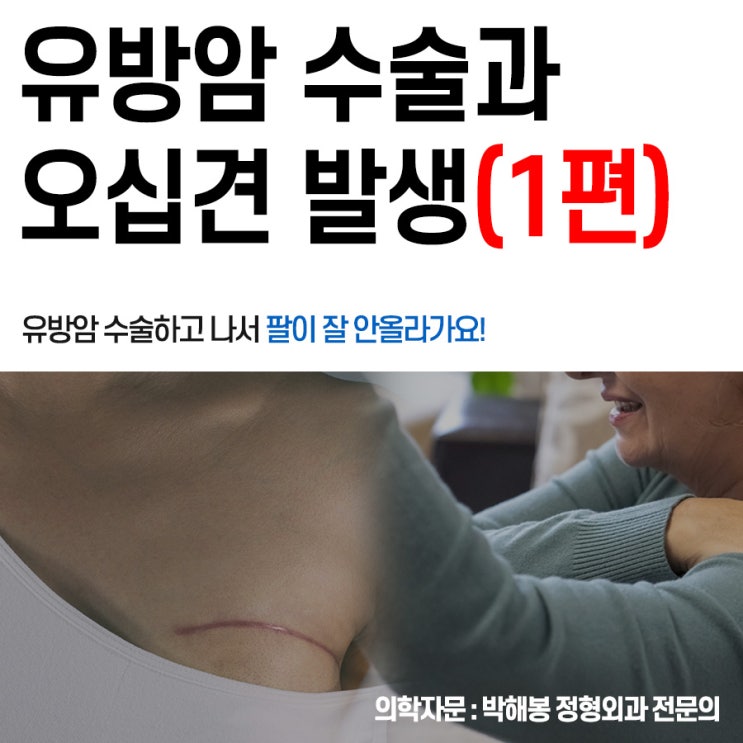 유방암수술 후 어깨가 안올라가고 아파요 오십견 1편 네이버 블로그